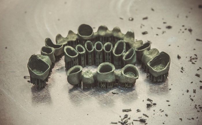 Tooth Fillings: Costs, Types, Procedure & Care