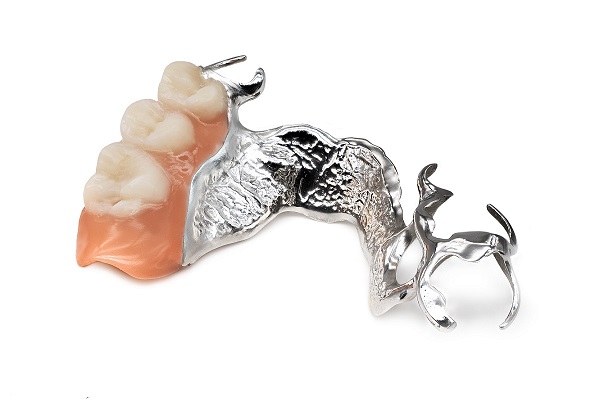 Cast Partial Dentures: Benefits, Costs & Care Guide