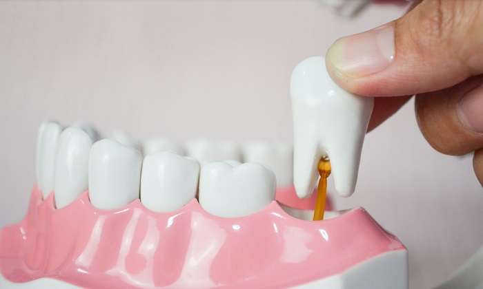 Braces Cost in India: Types, Pricing & Choosing the Right Orthodontist